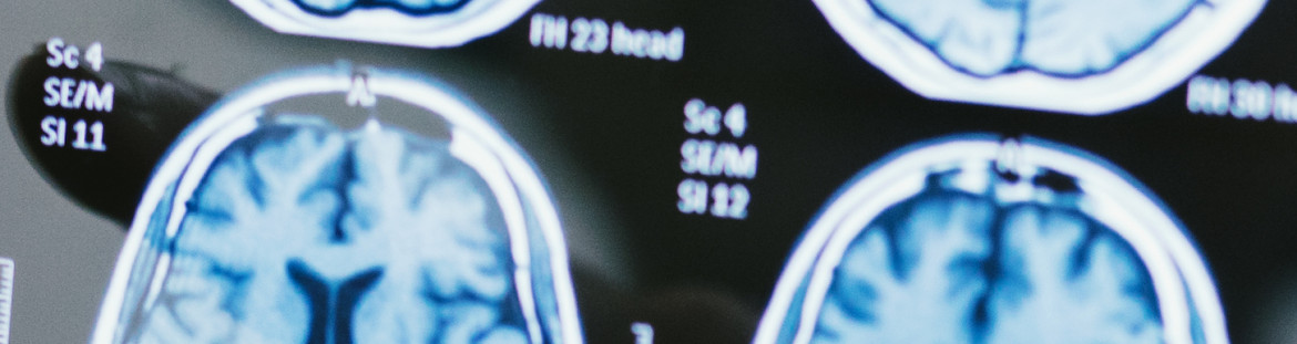 Neuroscience Services | Island Health