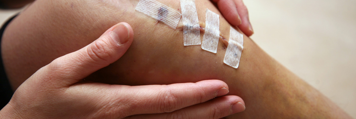 Recovering from Physical Injuries | Island Health