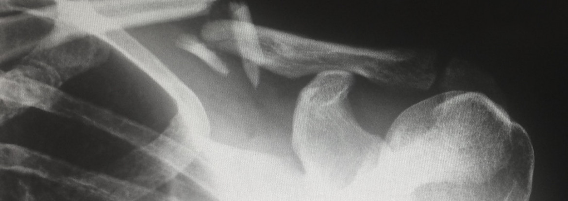 X-Rays (General Radiography) | Island Health